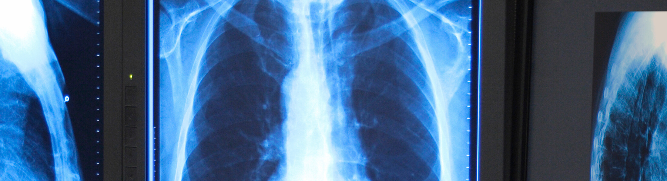 Radiologic Technology - Mitchell Technical College